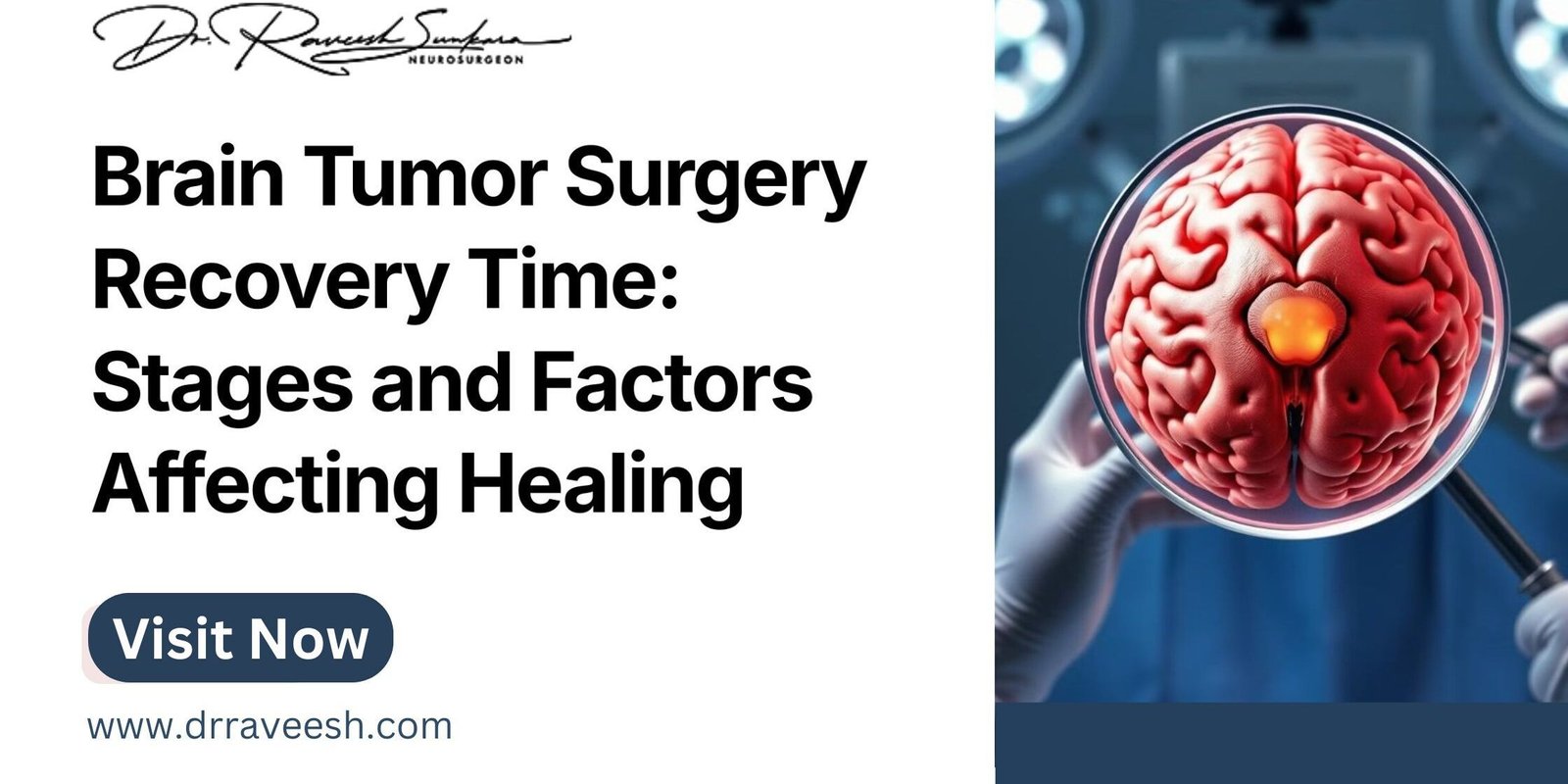 Brain Tumor Surgery Recovery Time: Stages and Factors Affecting Healing ...