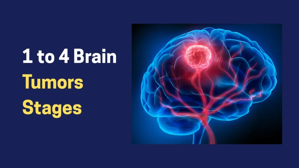 Stage 1 to Stage 4 Brain Tumors: Each Stage Means