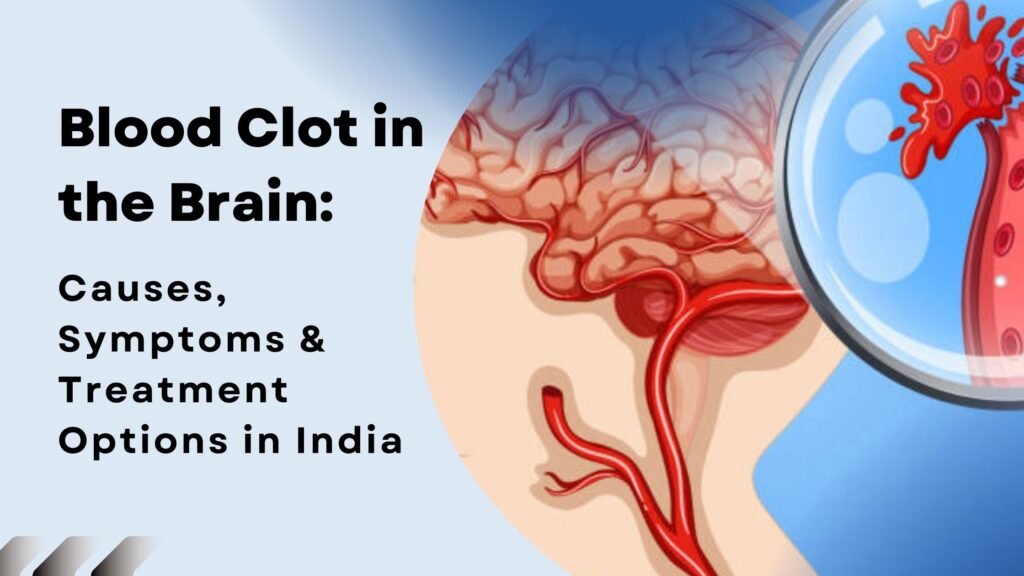 Blood Clot in Brain: Causes, Symptoms & Treatment in India