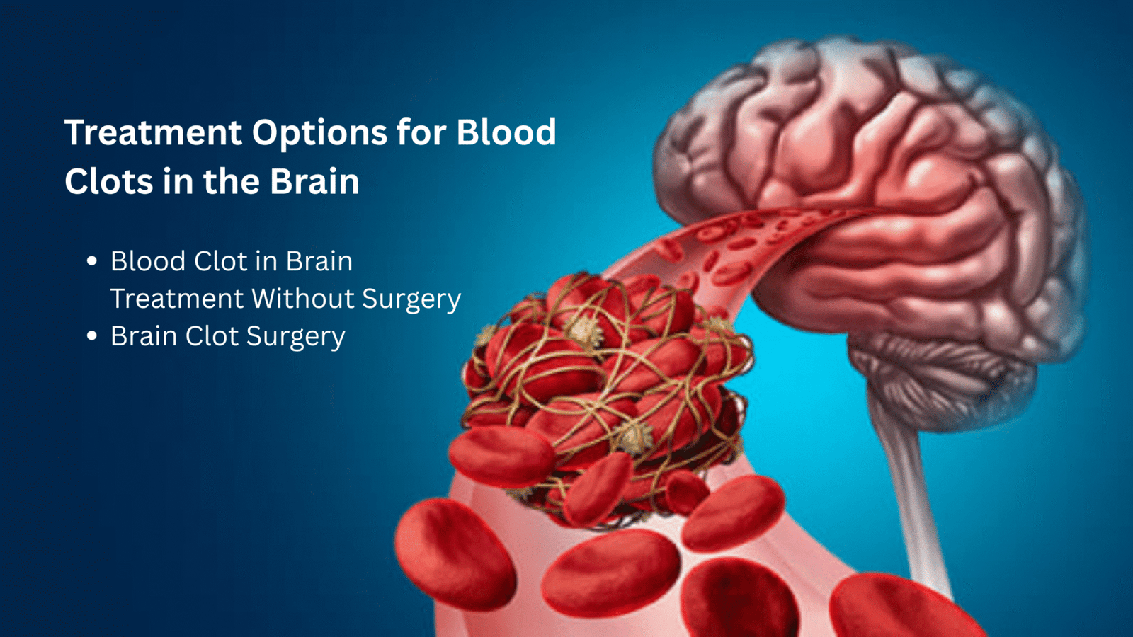 Blood Clot in Brain Treatment | Surgery & Recovery Guide